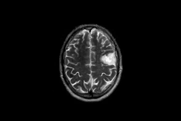 Isolation du patient: Comment transformer l'histoire de la maladie dans un projet d'art 6269_1