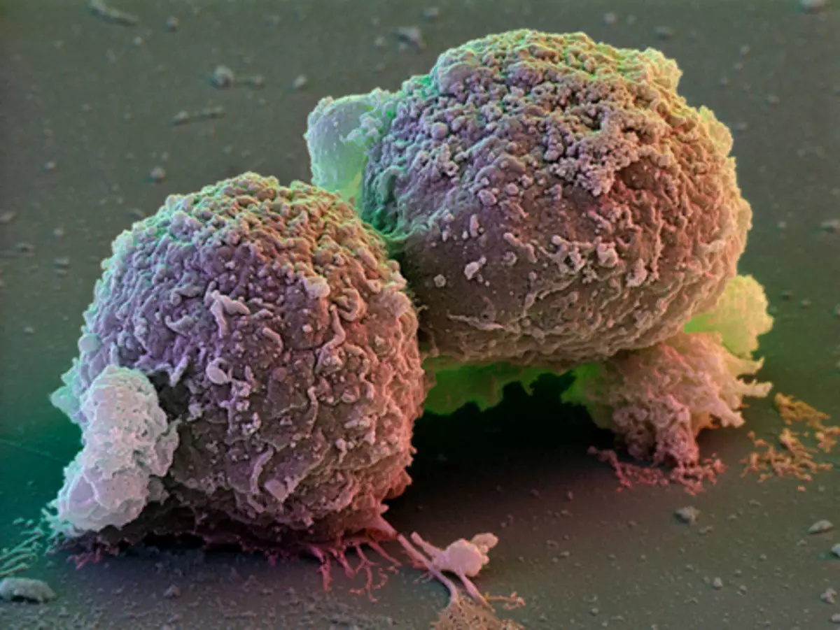 Cell fabriek: hoe blastosist het die wêreld verander? 7745_1