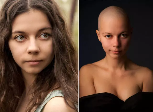 Vivo kun alopecia en Rusujo: Kiel vivi kaj labori post plena de kalvo, kiel la sinteno al alopecia ŝanĝiĝas en Rusujo kaj kion ni devas lerni de Eŭropo 15372_2